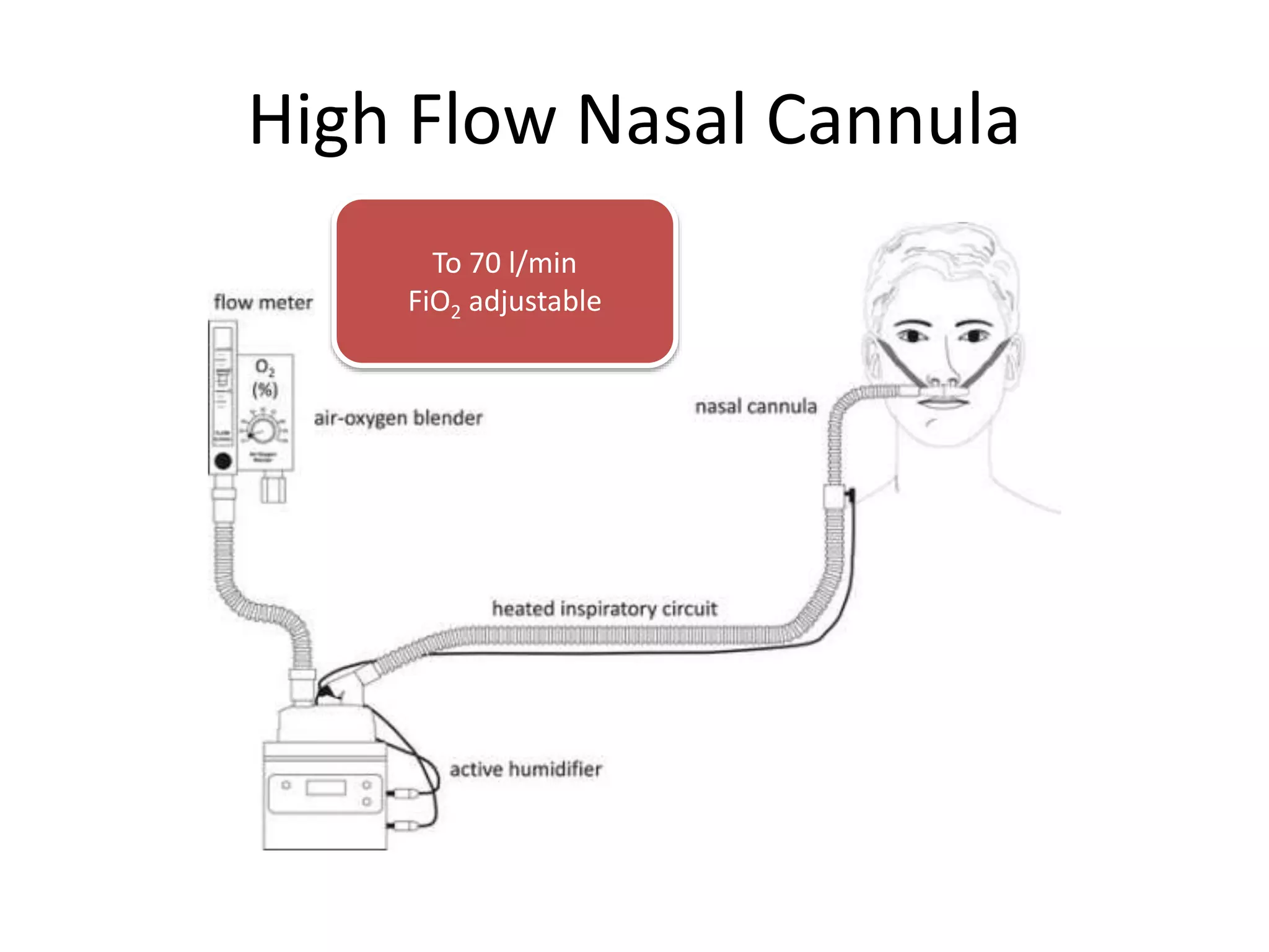 High flow nasal cannula | PPTX