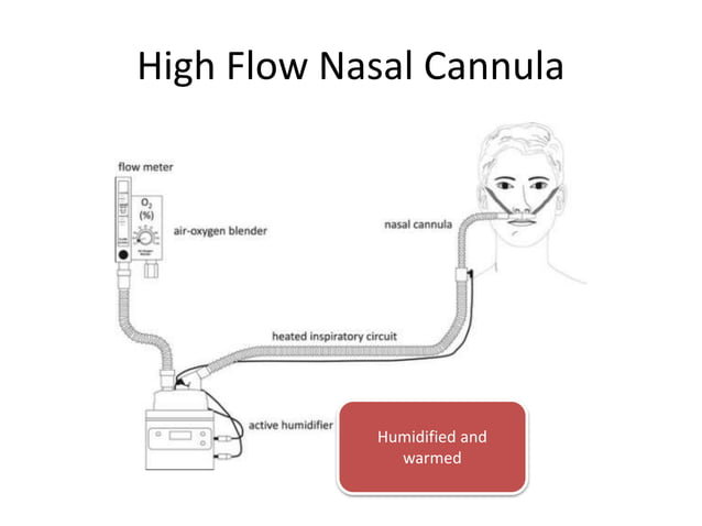 High flow nasal cannula