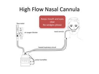 High Flow Nasal Cannula
