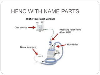 HFNC AND ITS SIGNIFICANCE.pptx | Lung and Respiratory Health | Diseases ...