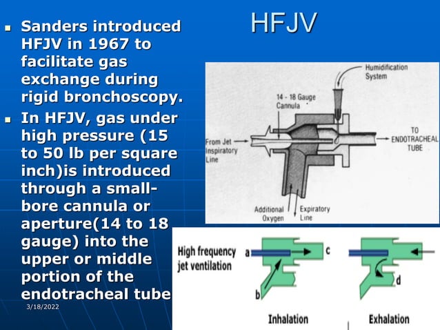 High Frequency Oscillatory Ventilation | PPSX