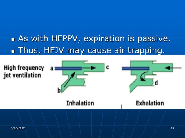 High Frequency Oscillatory Ventilation | PPSX