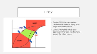 HFOV.pptx