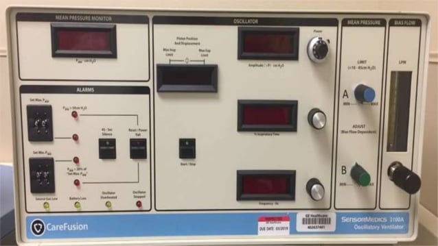 High-Frequency oscillatory ventilation HFOV | PPTX