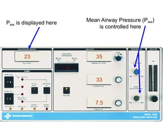 HFOV. High frequency oscillatory ventilation pediatric | PDF