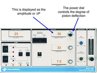 HFOV. High frequency oscillatory ventilation pediatric | PDF