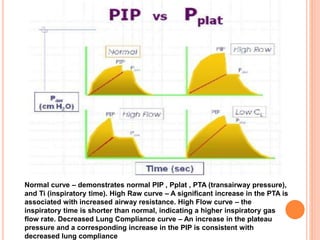 High frequency oscillatory ventilation- Basics | PPTX