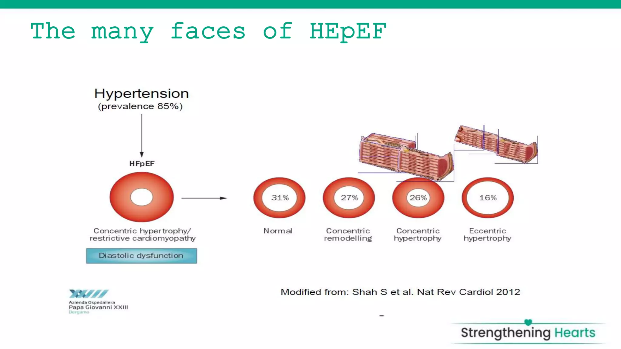 HeART FAILURE Hfpef | PPTX