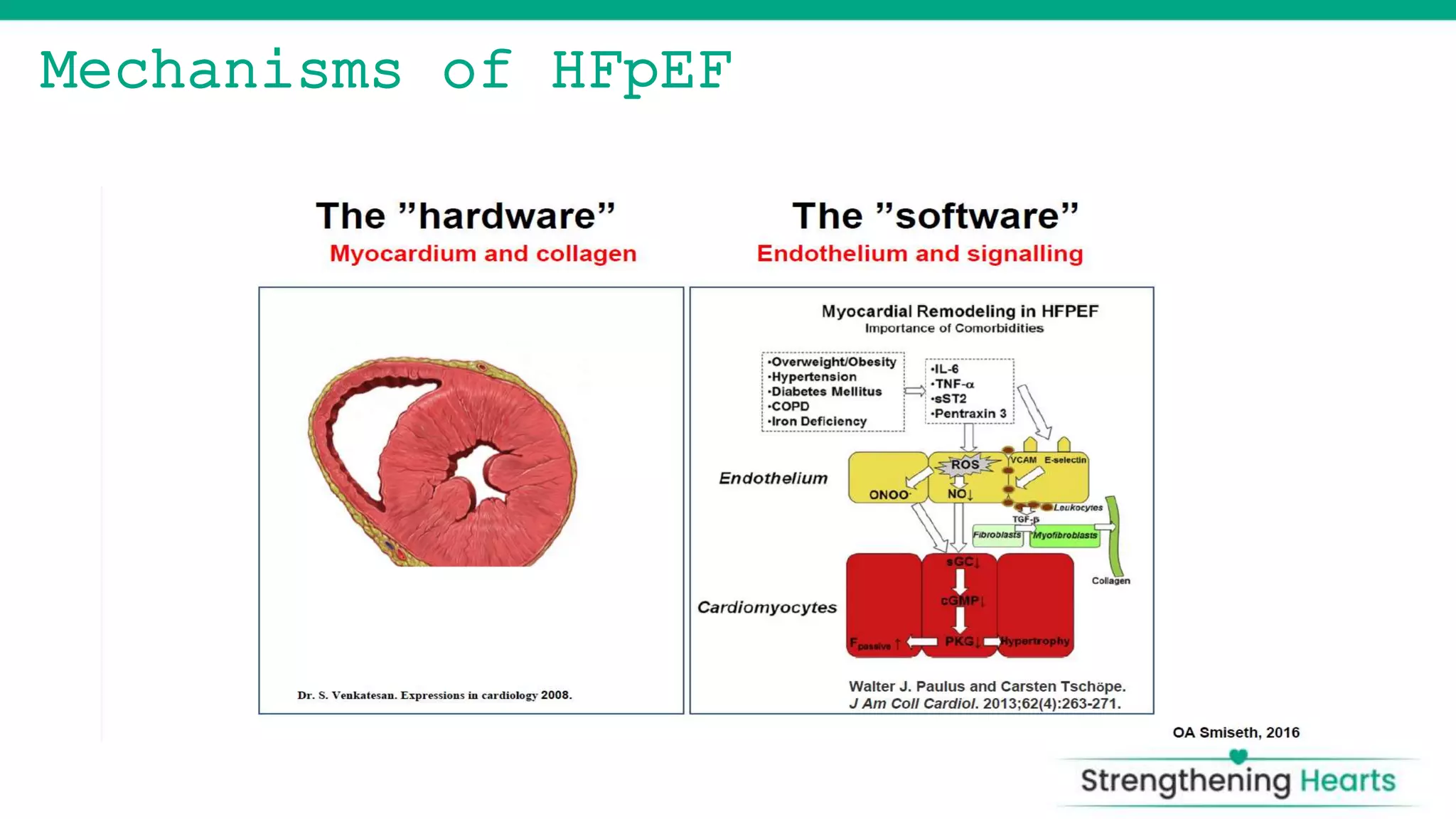 HeART FAILURE Hfpef | PPTX