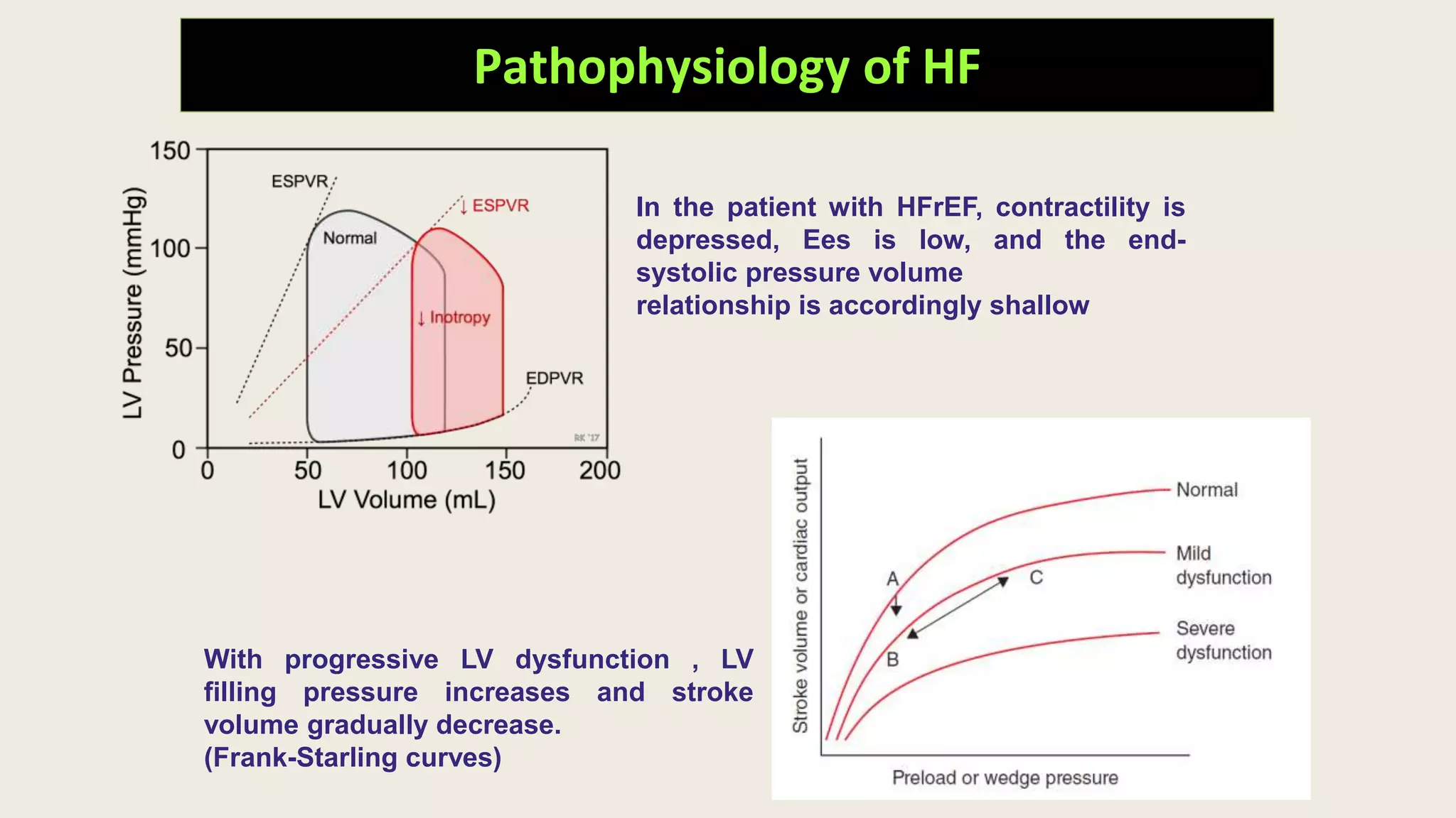 Heart Failure with Preserved Ejection Fraction By DR. Vaibhav Yawalkar ...