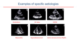 Heart Failure with Preserved Ejection Fraction By DR. Vaibhav Yawalkar ...