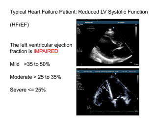 Heart Failure in Women: More than EF? | PPT
