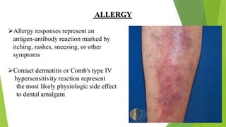 Hg Toxicity | PPTX