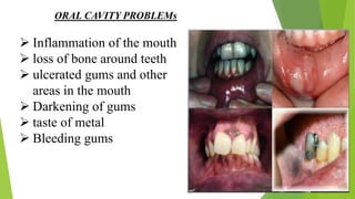 Hg Toxicity | PPTX