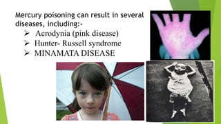 Hg Toxicity | PPTX
