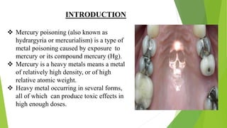 Hg Toxicity | PPTX