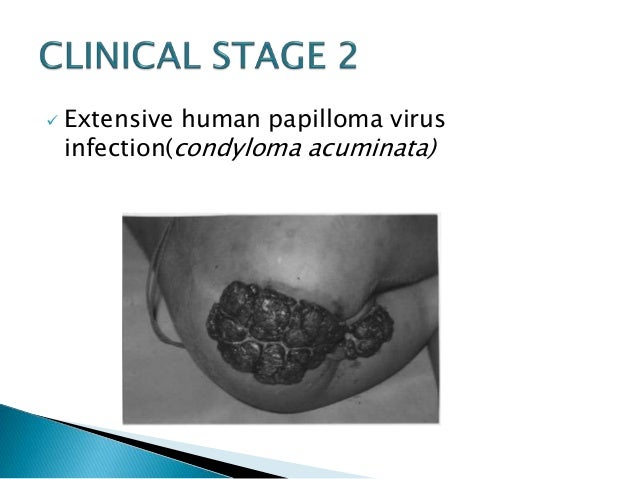 Staging and clinical manifestation of HIV