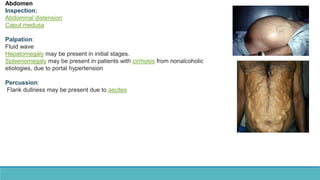 liver cirrhosis - abdominal distension | PPT