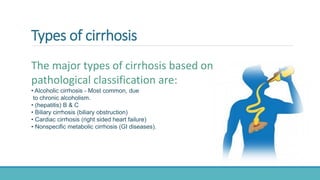 liver cirrhosis - abdominal distension | PPTX