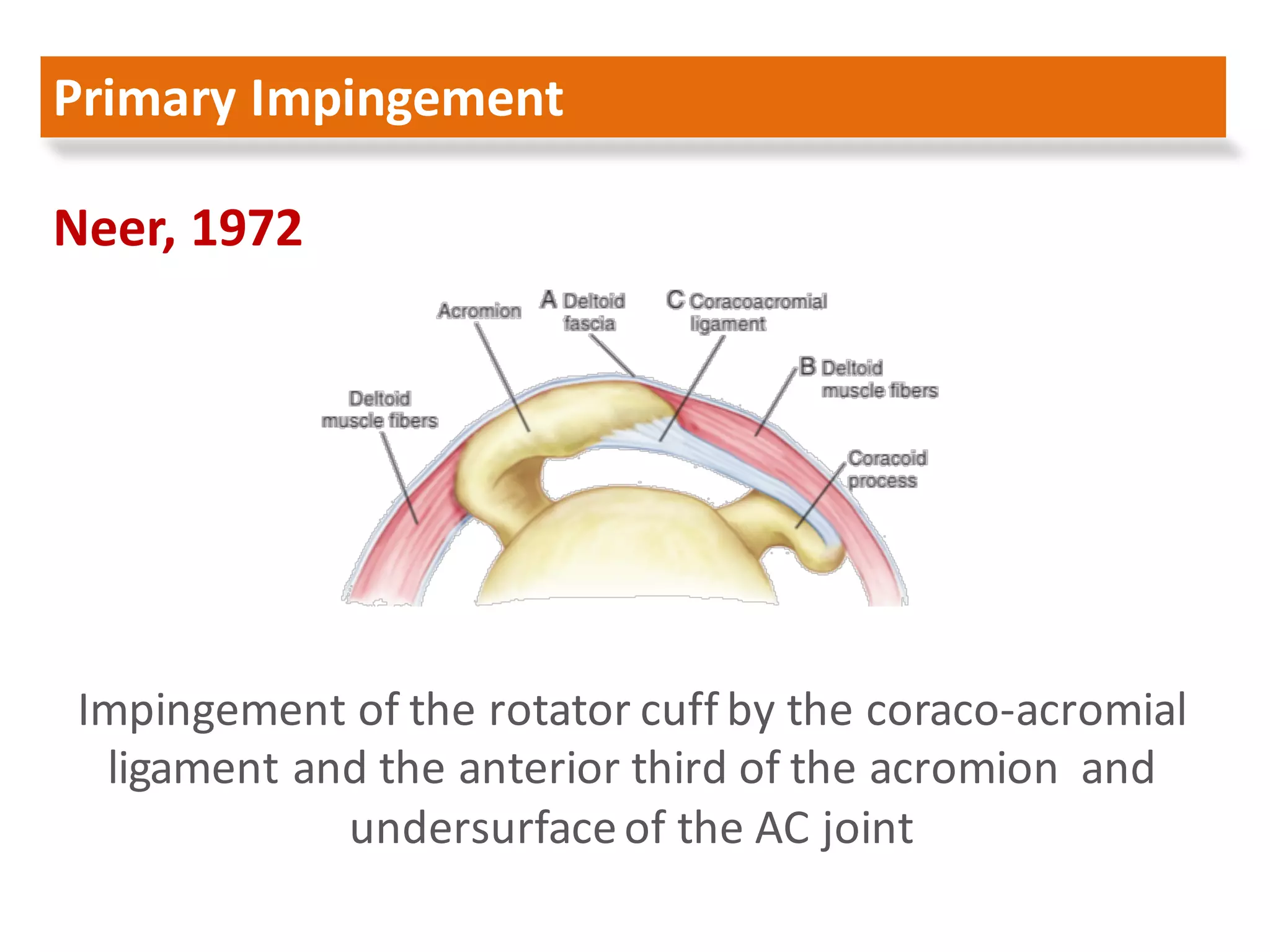 Shoulder impingement syndrome larissa 2016 | PDF