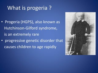 HGPS(Progeria disease) | PPT