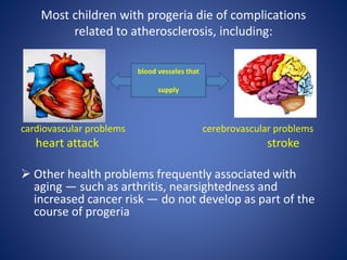 HGPS(Progeria disease) | PPT