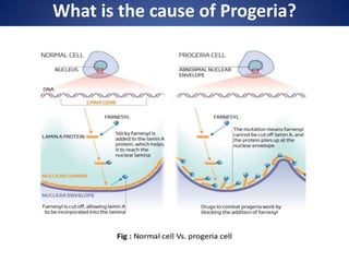 Progeria Cell Diagram