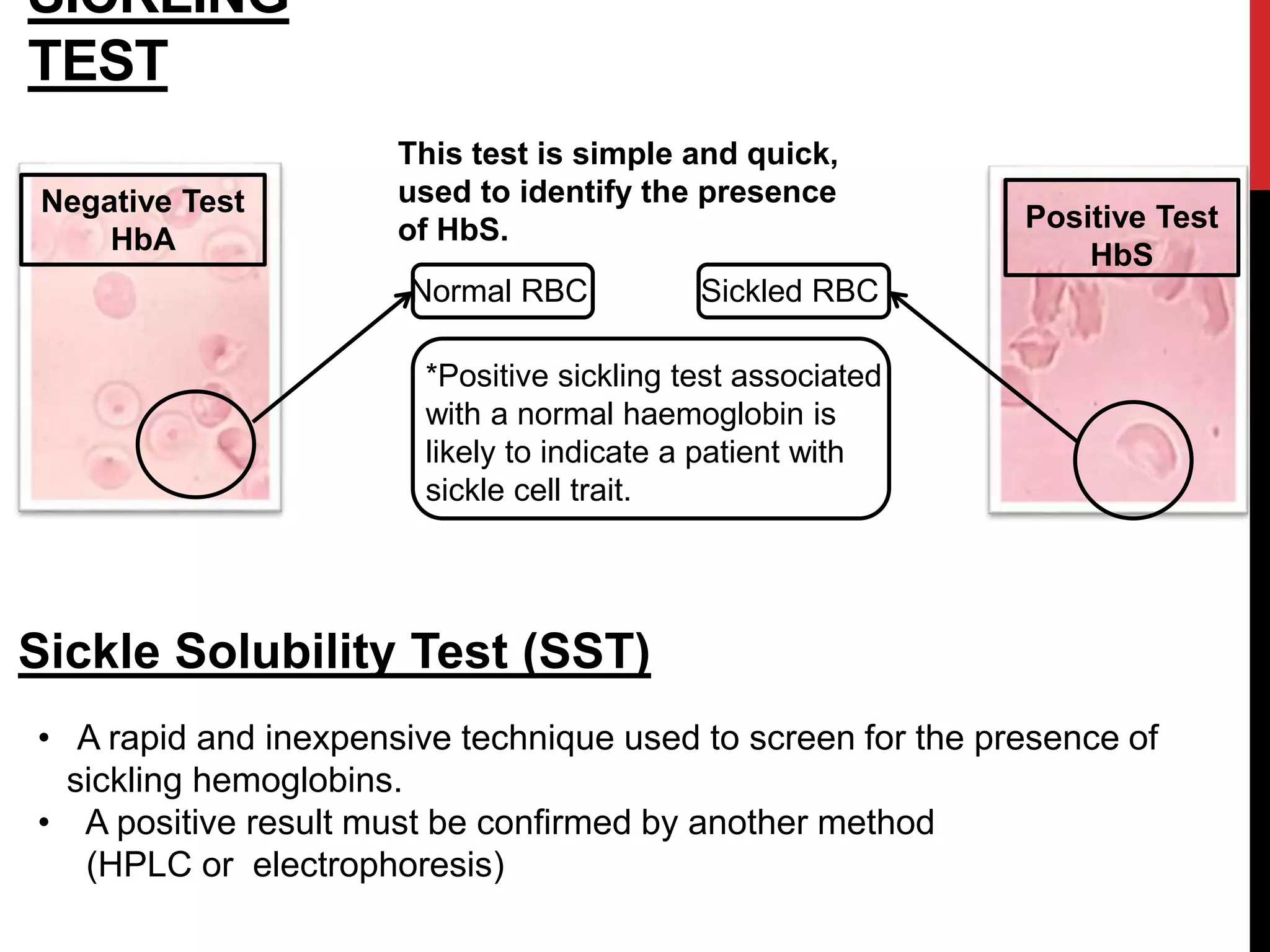Hereditary Hemolytic Anemias | PPTX