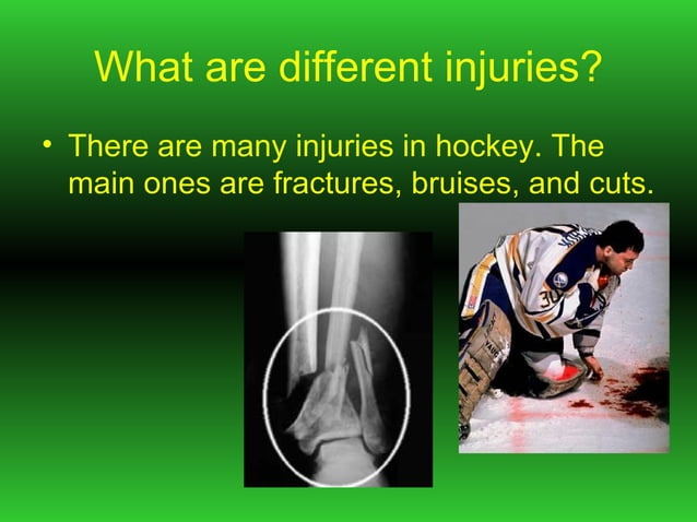Health 7 Hockey Injuries Powerpoint | PPT | Death, Injury, or Military ...