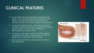 space infection of maxillary sinus chronic and acute | PPTX