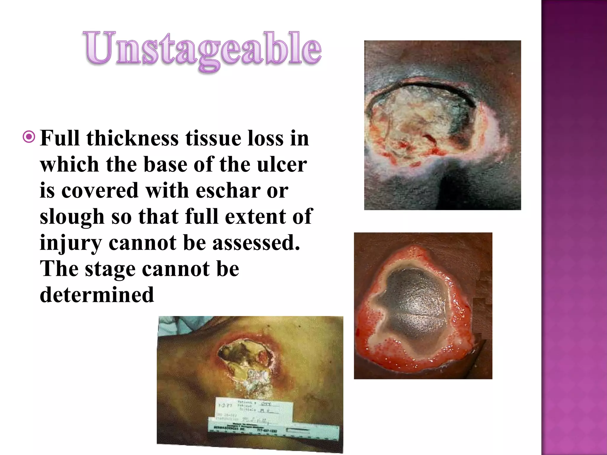 WOUND CARE | PPT