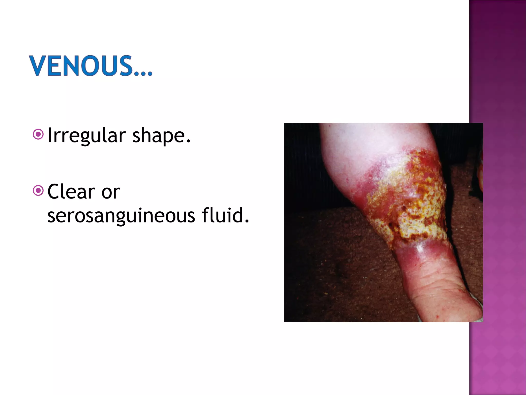 WOUND CARE | PPT