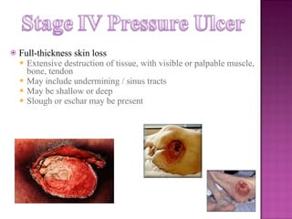 WOUND CARE | PPT