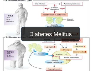 HHS in Diabetic Person | PPSX