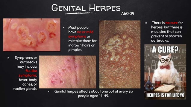 Female STD/STI Presentation | PPTX | Sexual Conditions | Sexual Health