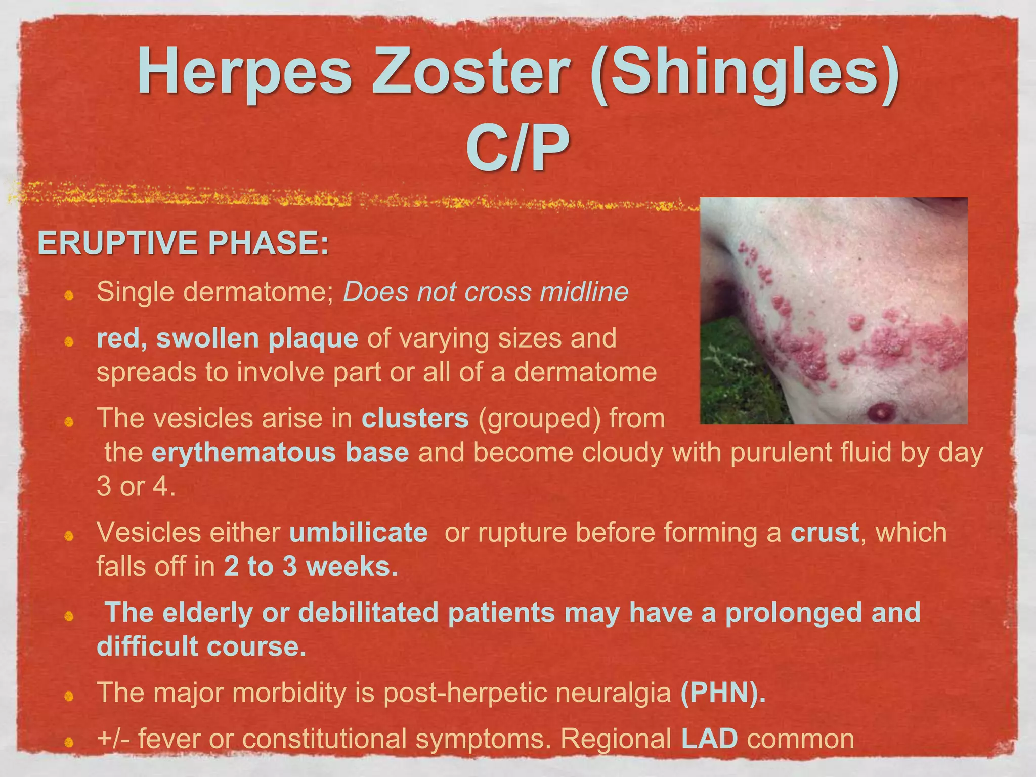 Human Herpesviruses3-8 | PPTX