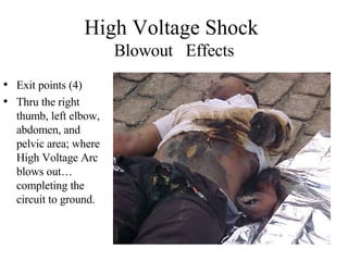 Hi Voltage Shockeffects | PPT