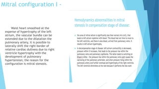 percussion of heart.pptx