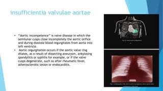 percussion of heart.pptx