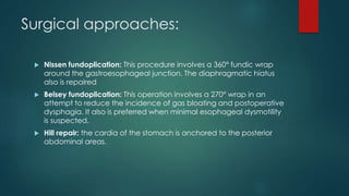Hiatal hernia | PPT