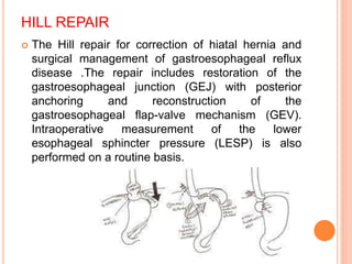 Hiatal Hernia.pptx