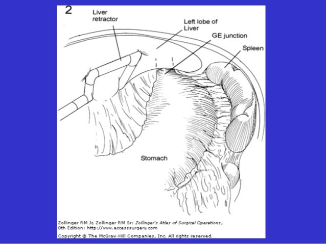 Semilunar Hiatus Wikipedia