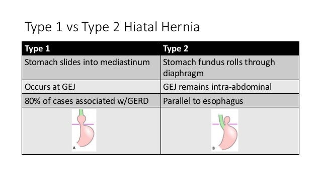 Hiatal hernias