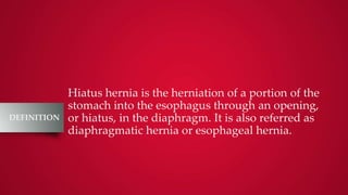Hiatus hernia | PPTX