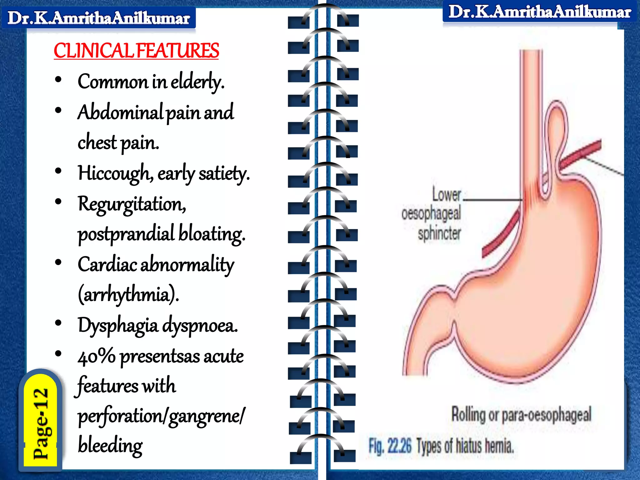 Hiatus hernia by Dr.K.AmrithaAnilkumar | PPT