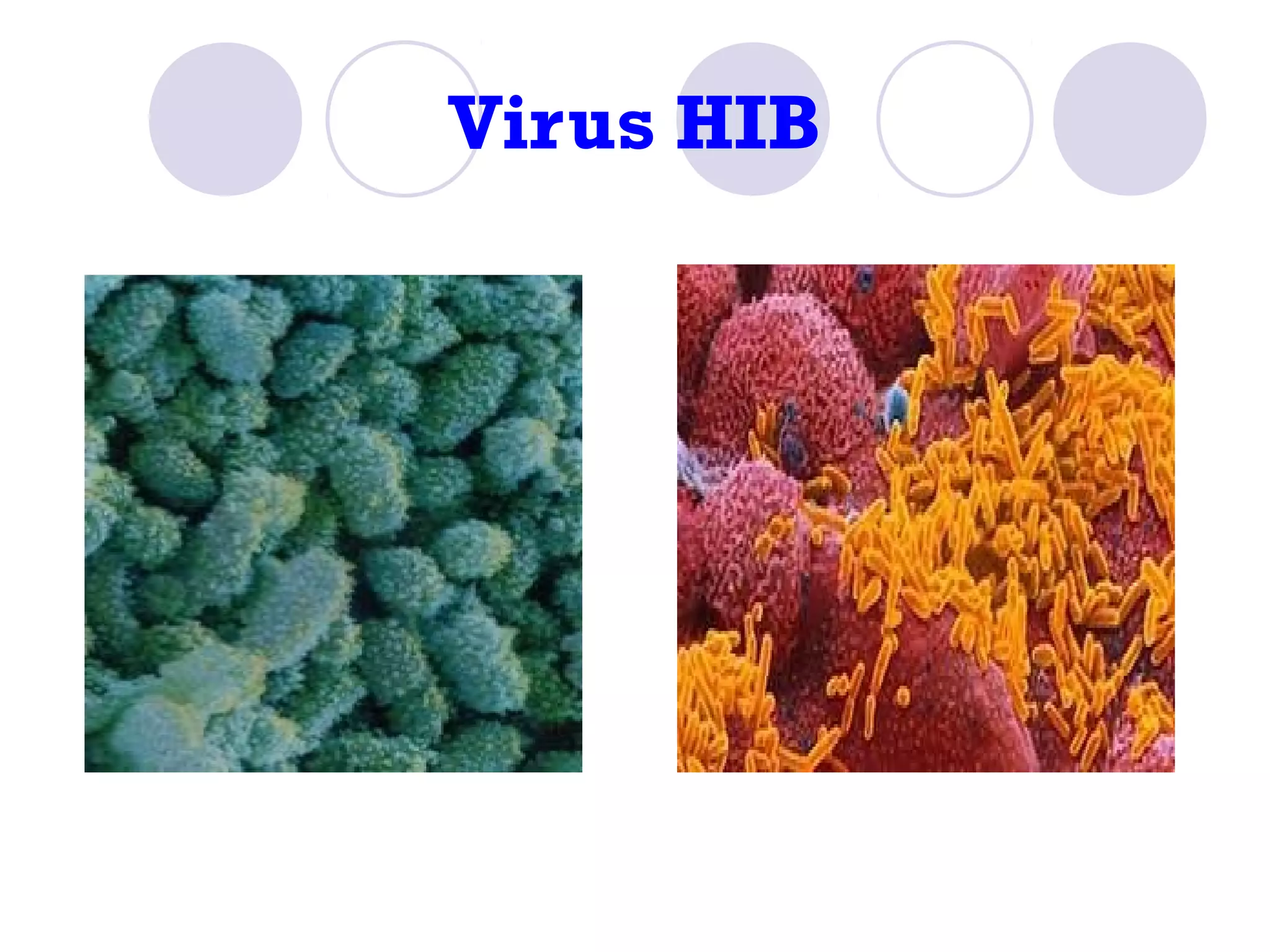 Hib prp t & hib prp-omp | PPT