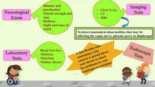 Hiccups ppt | PPTX
