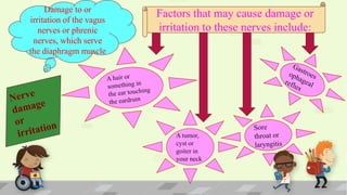Hiccups ppt | PPTX