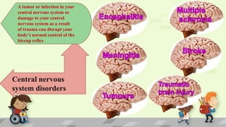 Hiccups ppt | PPTX