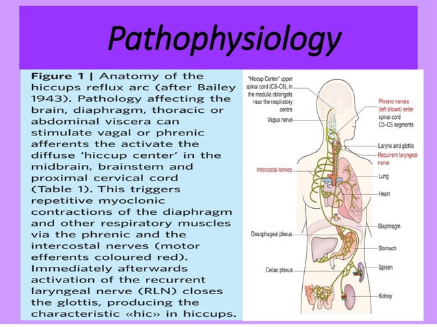 Hiccups (singultus)..pptxHiccups (singultus)..pptx